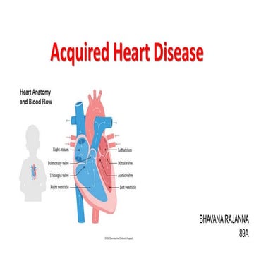 acqired heart diseases.pptx