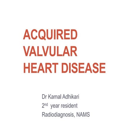 Acquired valvular heart disease | PPTX