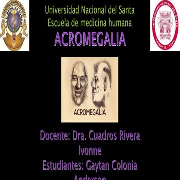 ACROMEGALIA.pptx