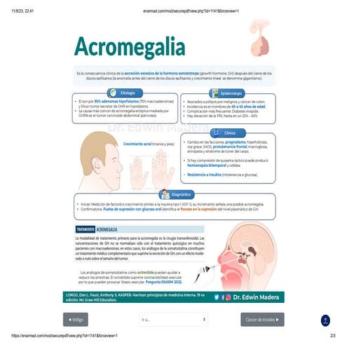acromegalia.pdf