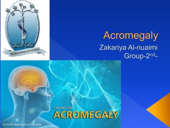 Cushings syndrome | PPT