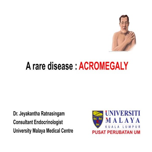 slide about Acromegaly amongs children.pdf