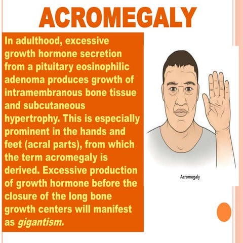 Acromegaly 1 | PPT
