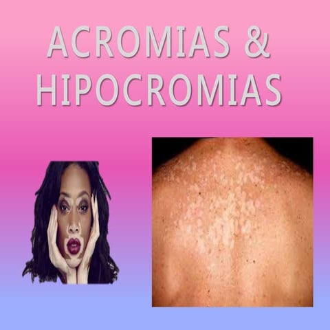 Acromias e hipocromias by:Fernandes | PPT