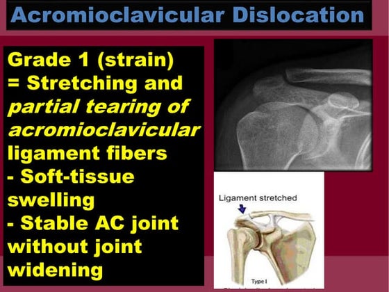 Acromegaly 1 | PPT