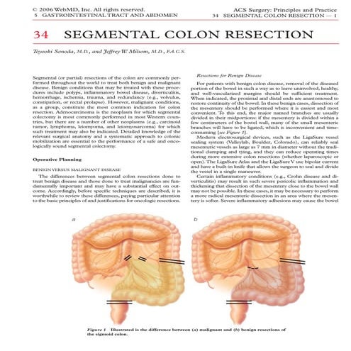 Acs0534 Segmental Colon Resection 2006 | PDF
