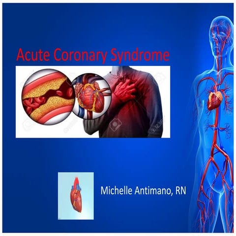Acute Coronary Syndrome | PPT