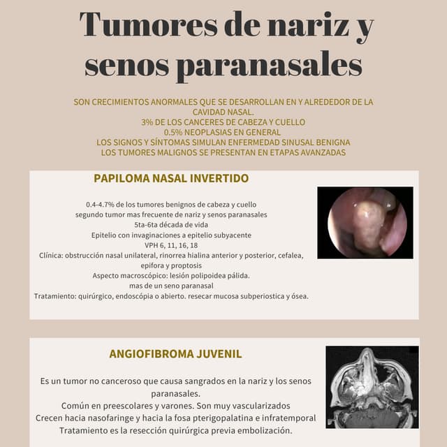 Cancer de cavidad nasal y senos paranasales | PPTX