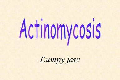 Actinomyces Lumpy Jaw