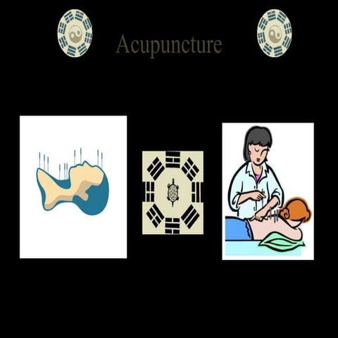 Acupuncture | PPTX