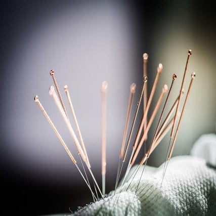 Needles use in Acupuncture Therapy | PDF