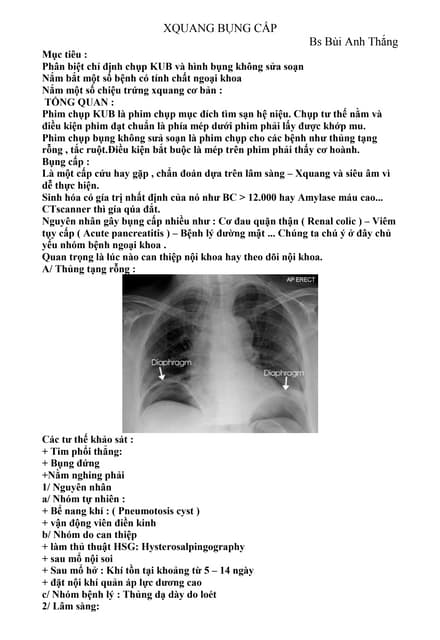 X-quang trong chẩn đoán tắc ruột | PPS