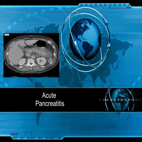 Acute pancreatitis | PPT