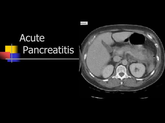 CASE PRESENTATION ON ACUTE PANCREATITIS | PPTX