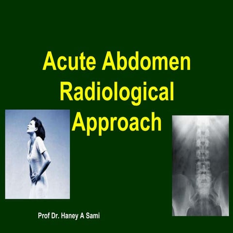 abdominal x ray radiology | PPTX