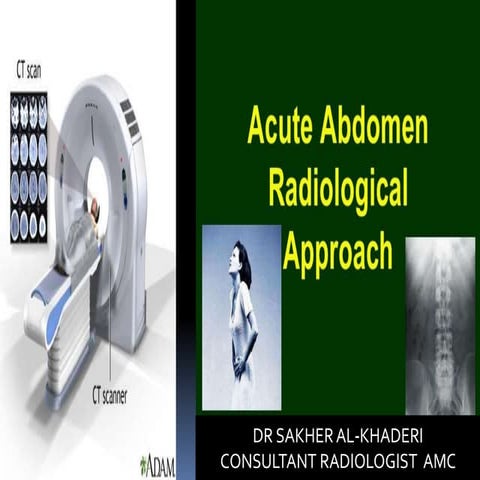 Imaging of Acute Abdomen | PPTX