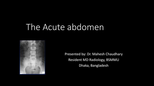 X ray signs of abdomen | PPTX