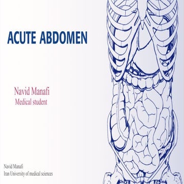 Acute abdomen | PDF