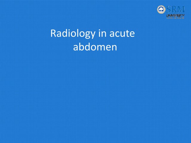 X ray signs of abdomen | PPTX