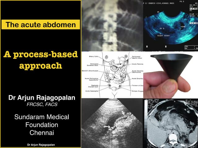 The Acute Abdomen A Process Based Approach Ppt