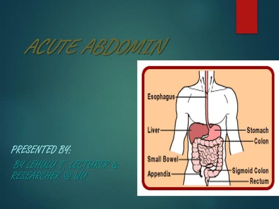 Acute Abdominal pain - Presented by: Aliza Fatima (24) & Mehran Khan ...
