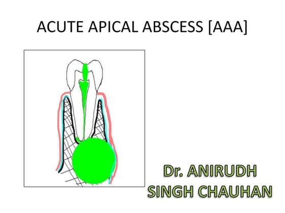 ACUTE APICAL ABSCESS | PPT