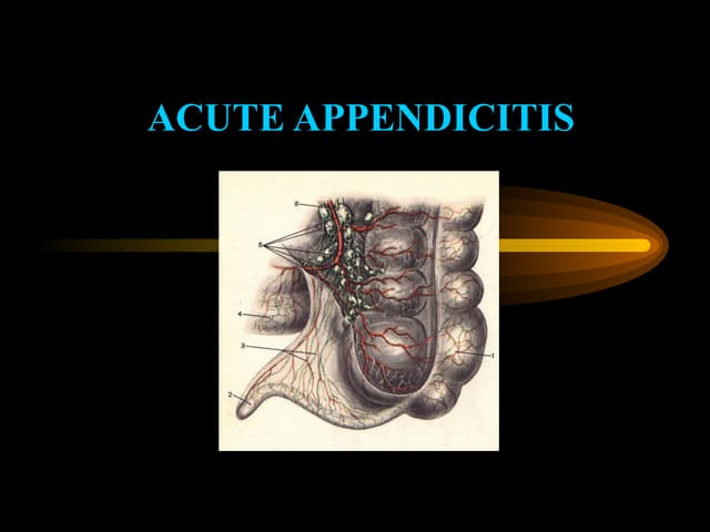 Atypical Presentations of Appendicitis.pptx