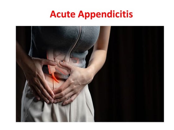 Classification of acute appendicitis.pptx | Digestive Disorders ...