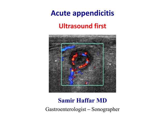 JNET classification of colo rectal polyps | PPTX