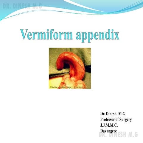 Acute Appendicitis | PPTX