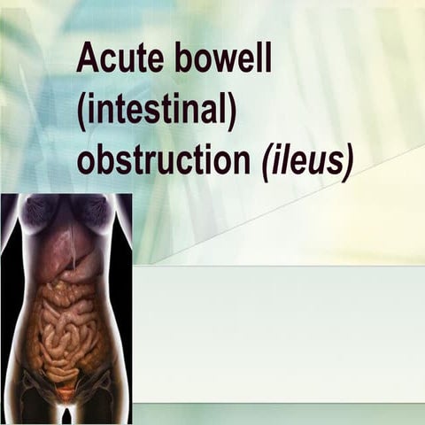 Acute bowel obstuction (lecture mogilevec e.v) | PDF