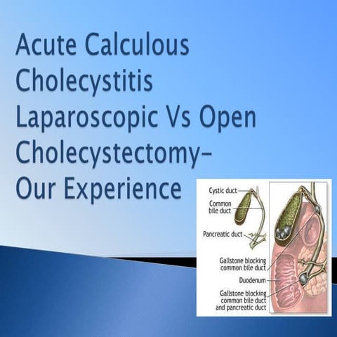 Acute Calculus Cholecystitis Open Vs Lap.pptx