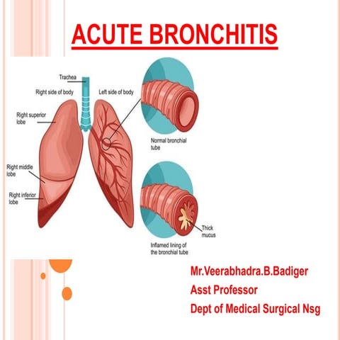 Acute and chronic Bronchitis & Nursing care | PPT