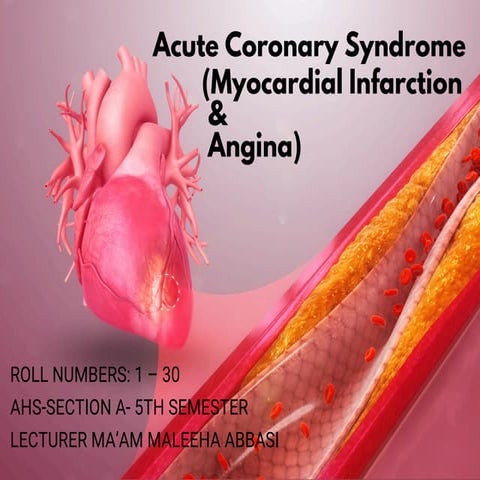 Acute Coronary Syndrome Myocardial Infarction and Angina.pdf