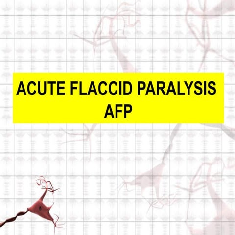 Acute flaccid paralysis: make it easy | PPT
