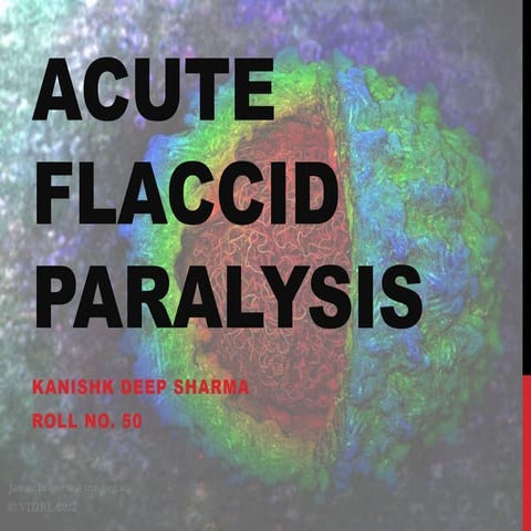 Acute flaccid paralysis | PPT