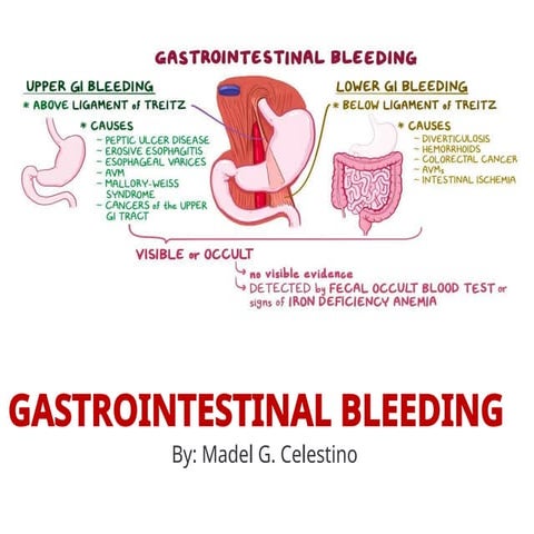 ACUTE GASTROINTESTINAL BLEEDING1-WPS Office.pptx