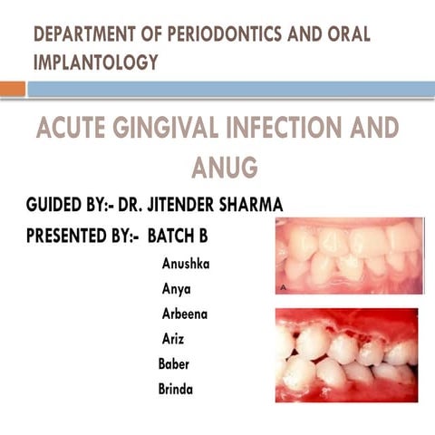 (Nug) and (nup) | PDF
