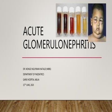 Acute Glomerulonephritis Guide | PPT