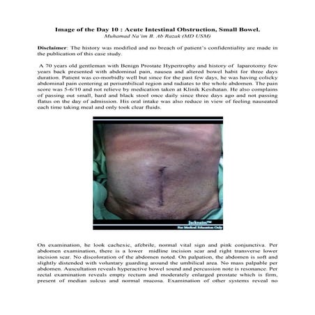 Acute intestinal obstruction, small bowel | PDF