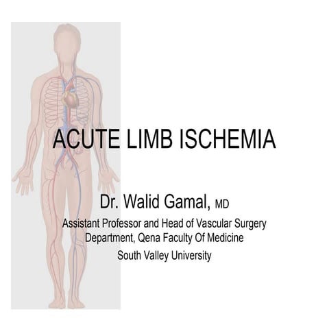 Acute Limb Ischemia - embolectomy, endovascular treatment, hybrid ...