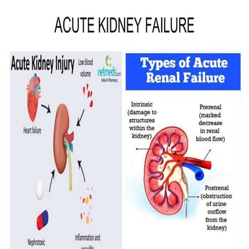 Acute renal failure | PPTX