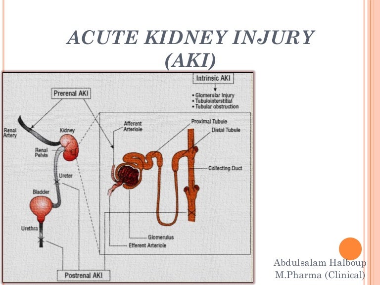 Acute kidney injury(AKI)