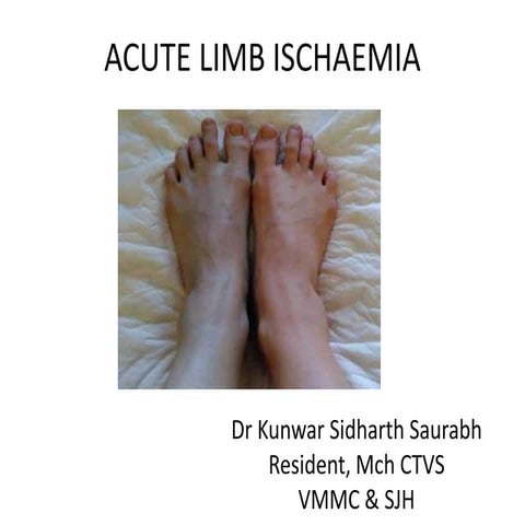 Acute limb ischaemia | PPT