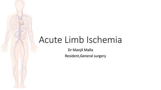 Acute Limb Ischemia | PDF