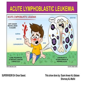 Acute Lymphoblastic Leukemia Leukemia 3 Pdf