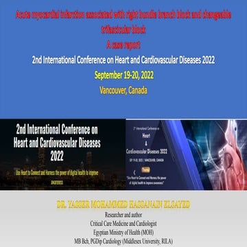 Acute myocardial infarction associated with right bundle branch block ...