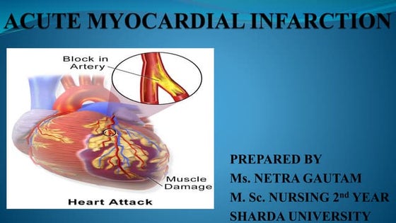 Chest pain: nursing assessment and management | PPT
