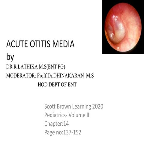 Acute suppurative otitis media | PPT