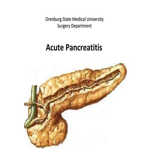 Acute pancreatitis.ppt